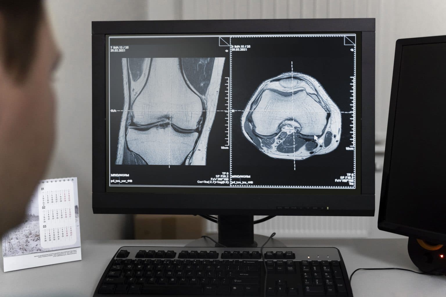IRM genou : déroulement, étapes et conseils pour l’examen